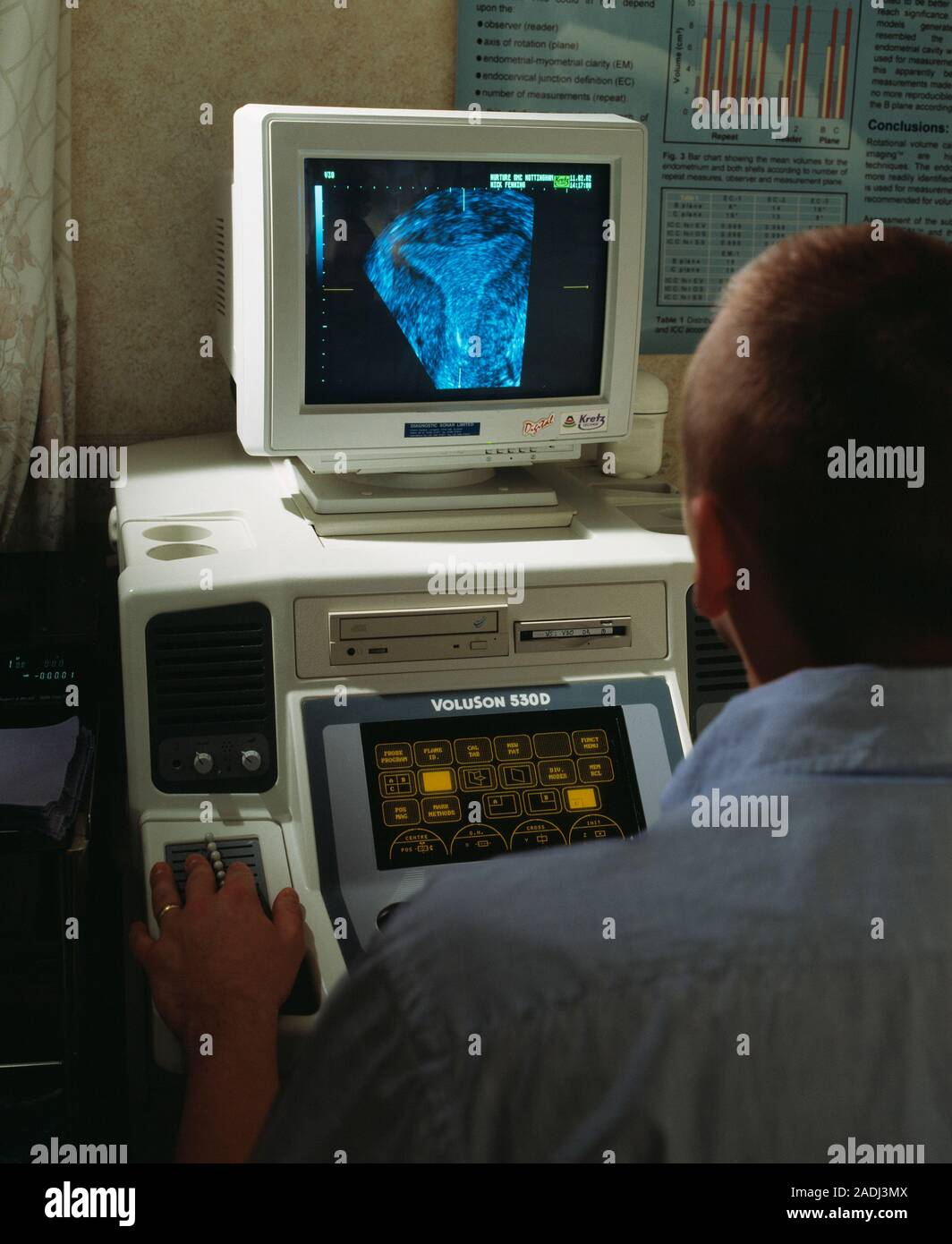 Ultrasound scan. Gynaecologist performing an ultrasound scan of a woman ...