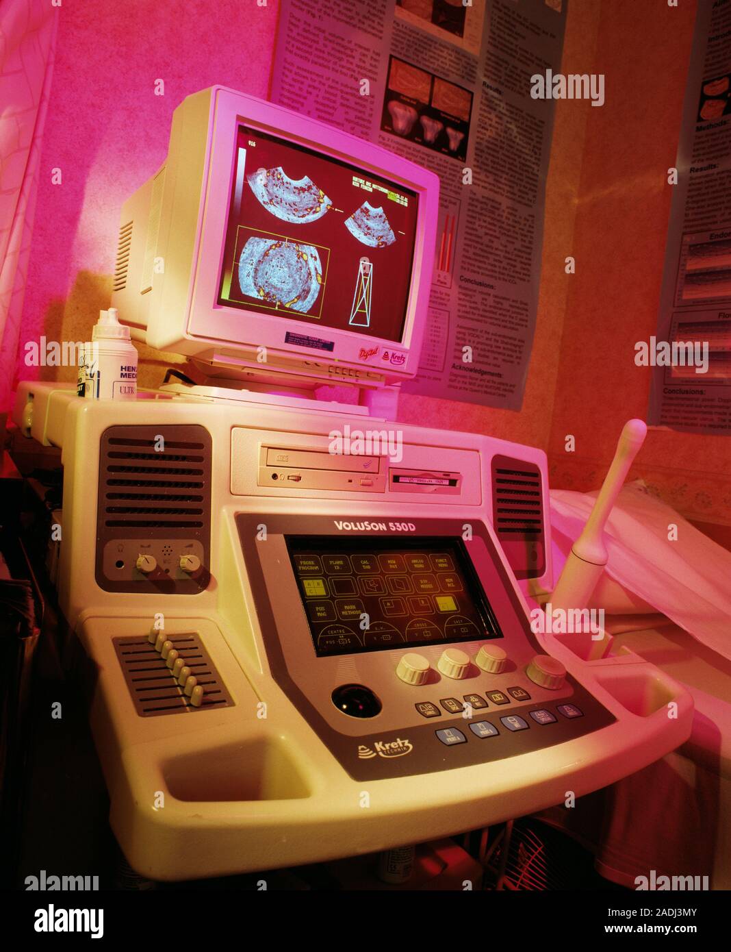 Ultrasound scanner. This machine uses sound waves to build up internal ...