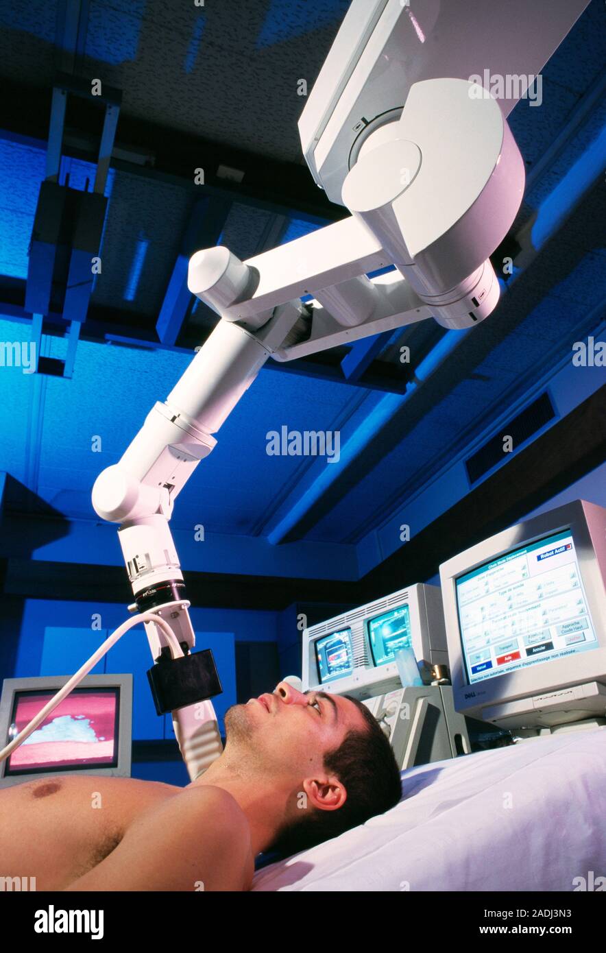 Artery scanning robot. Hippocrate robotic system performing a vascular ...