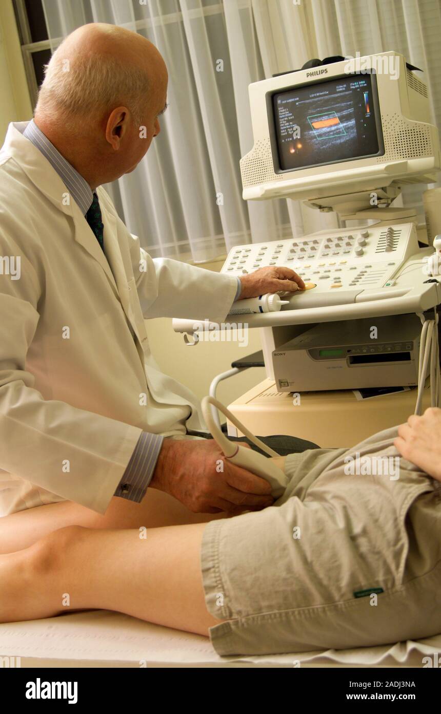 Doppler ultrasound. Doctor holding an ultrasound transducer next to a ...