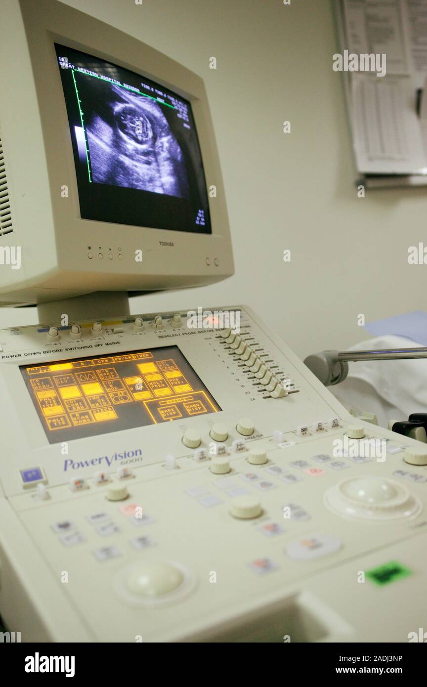 Pregnancy ultrasound. Ultrasound machine and its screen display of a ...