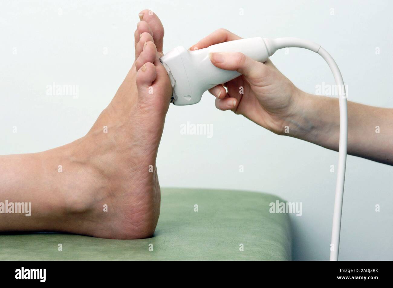 Podiatric ultrasound. Podiatrist performing an ultrasound examination ...