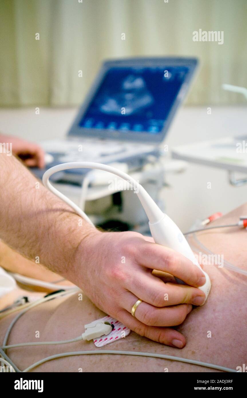 Heart ultrasound. A patient having an echocardiogram taken of his heart ...