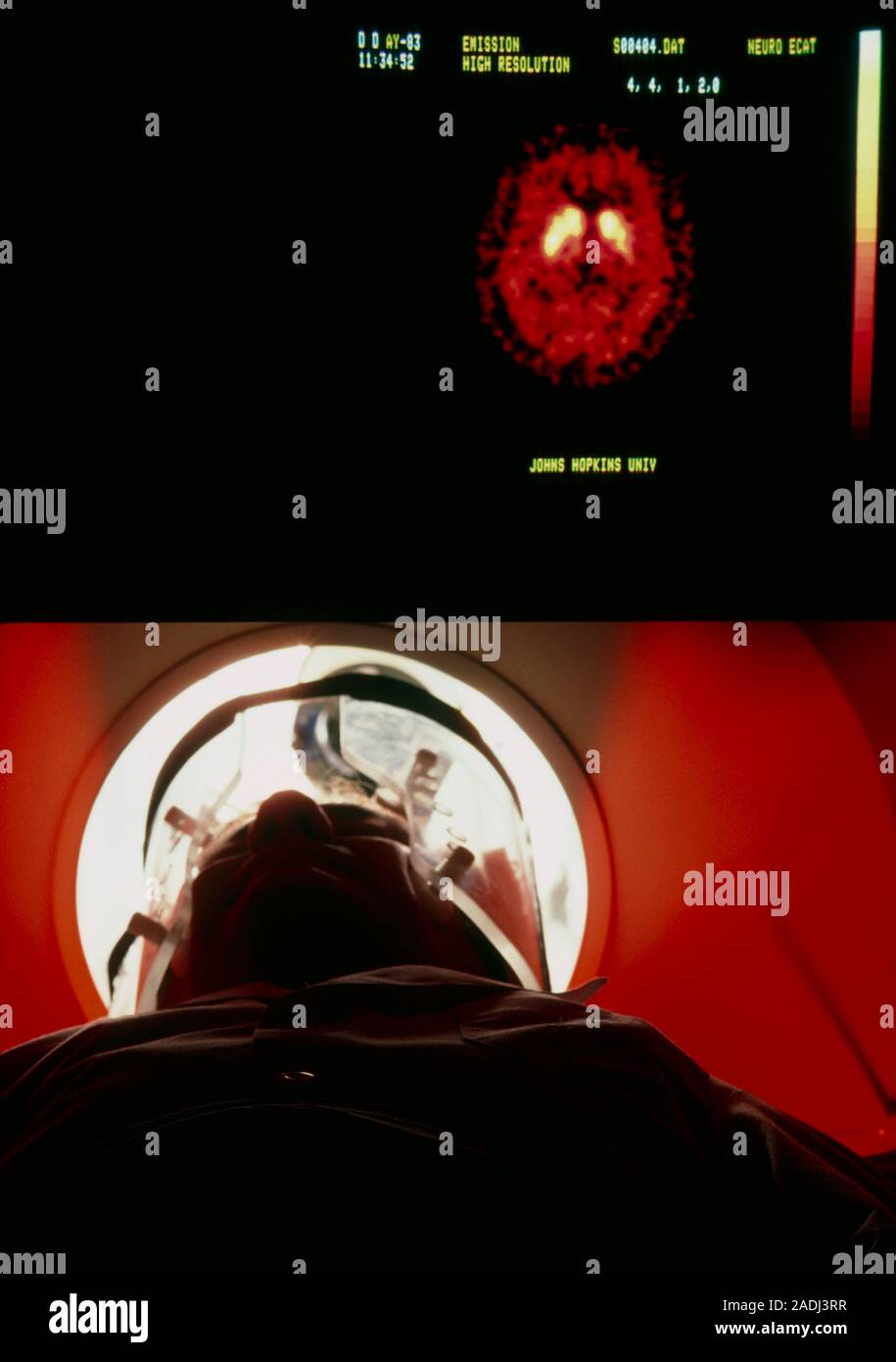 Person undergoing brain scan technique known as Positron Emission ...