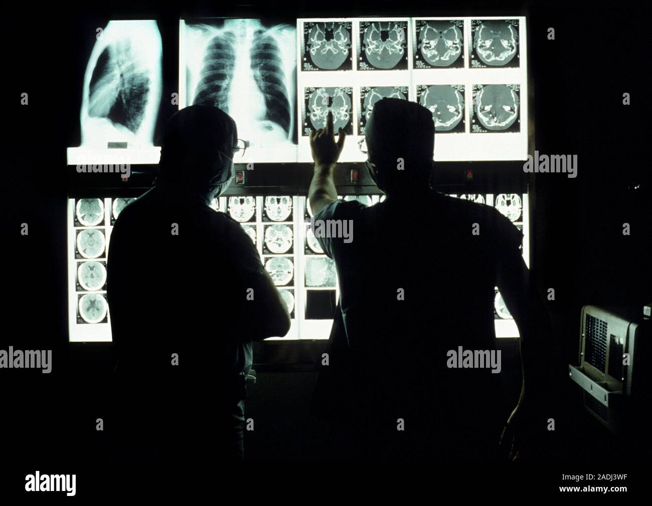 CT scan diagnosis. Two male surgeons seen in silhouette, examine ...