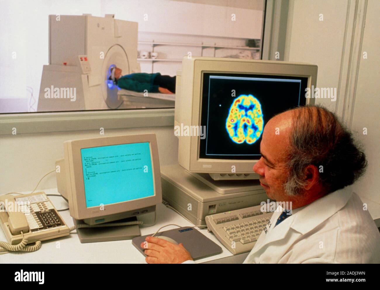 PET scanning. View of a patient undergoing a Positron Emission ...