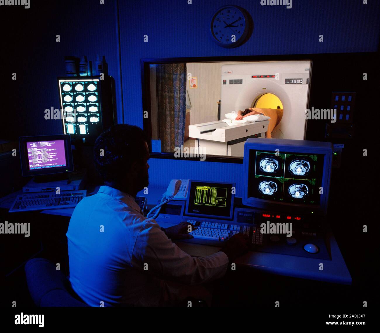 CT scanning. Woman patient under- goes a CT (Computed Tomography or CAT ...