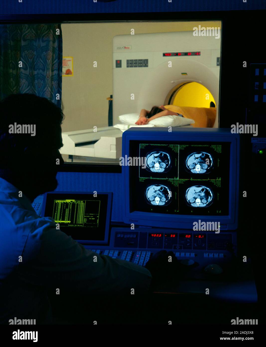 CT scanning. Patient having a CT (computed tomography or CAT) scan of ...
