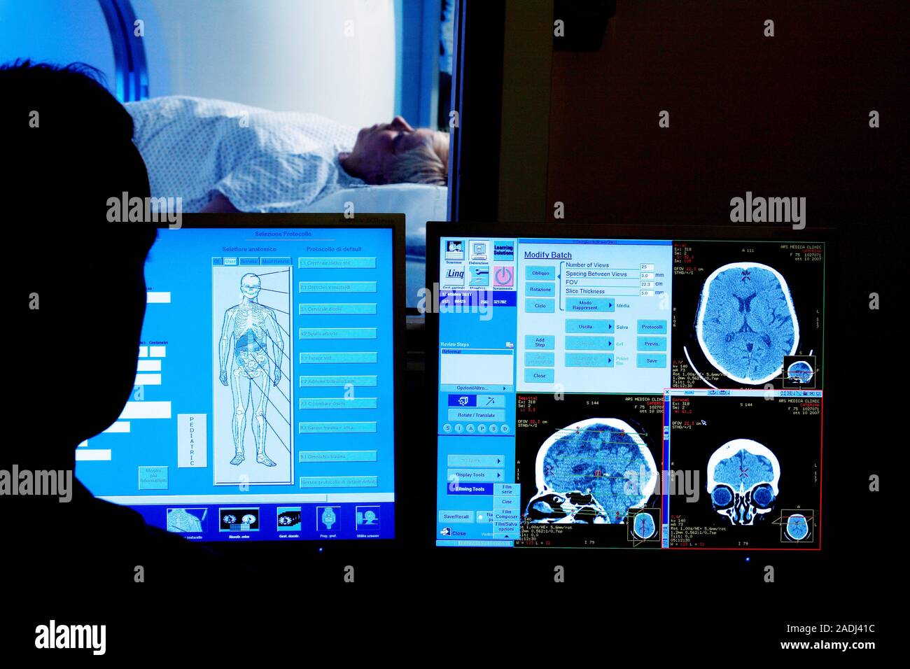 CT scanning. Radiographer (silhouetted, left) analysing CT scan images ...