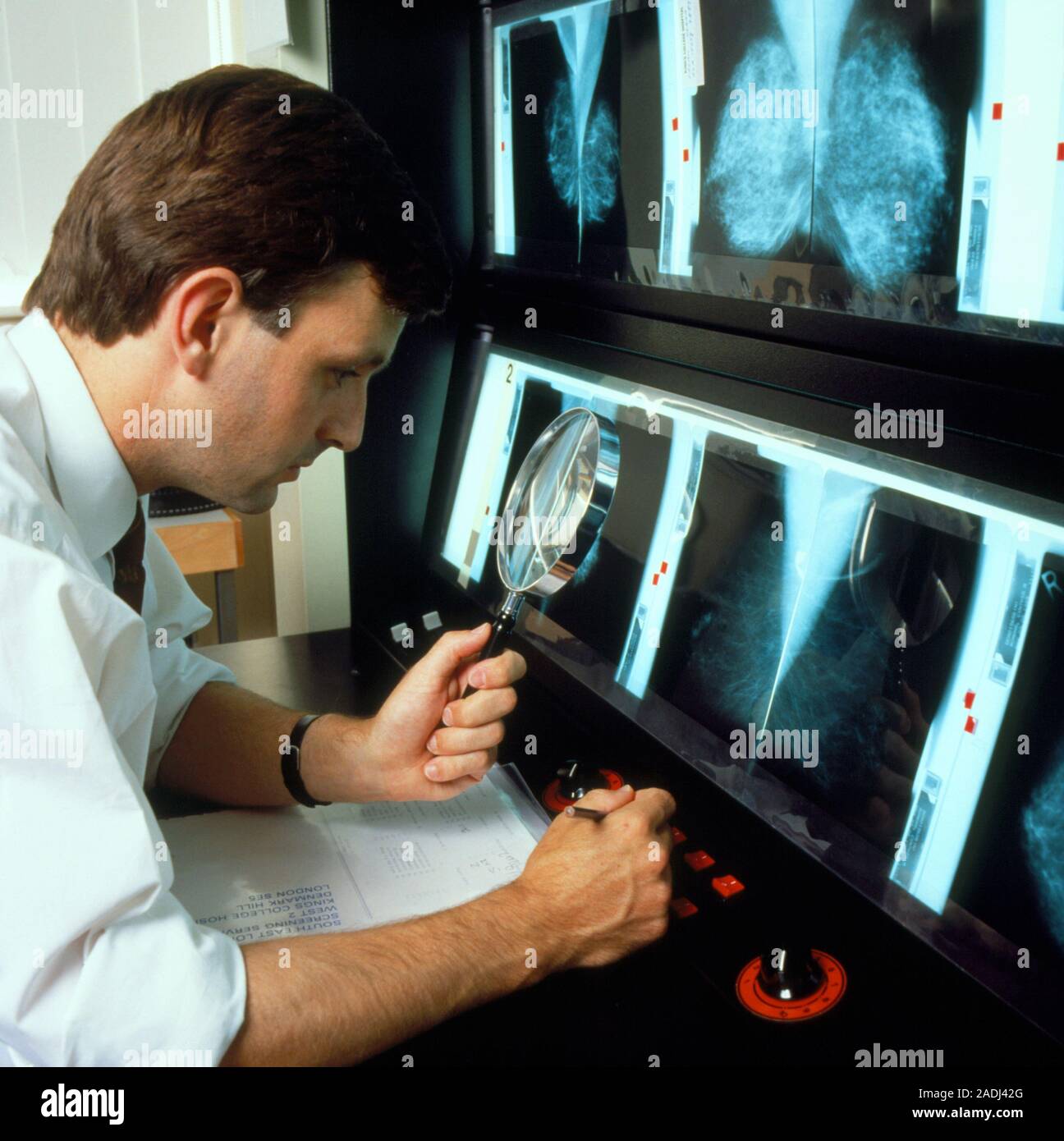 Radiologist examining a series of mammograms arranged against a ...