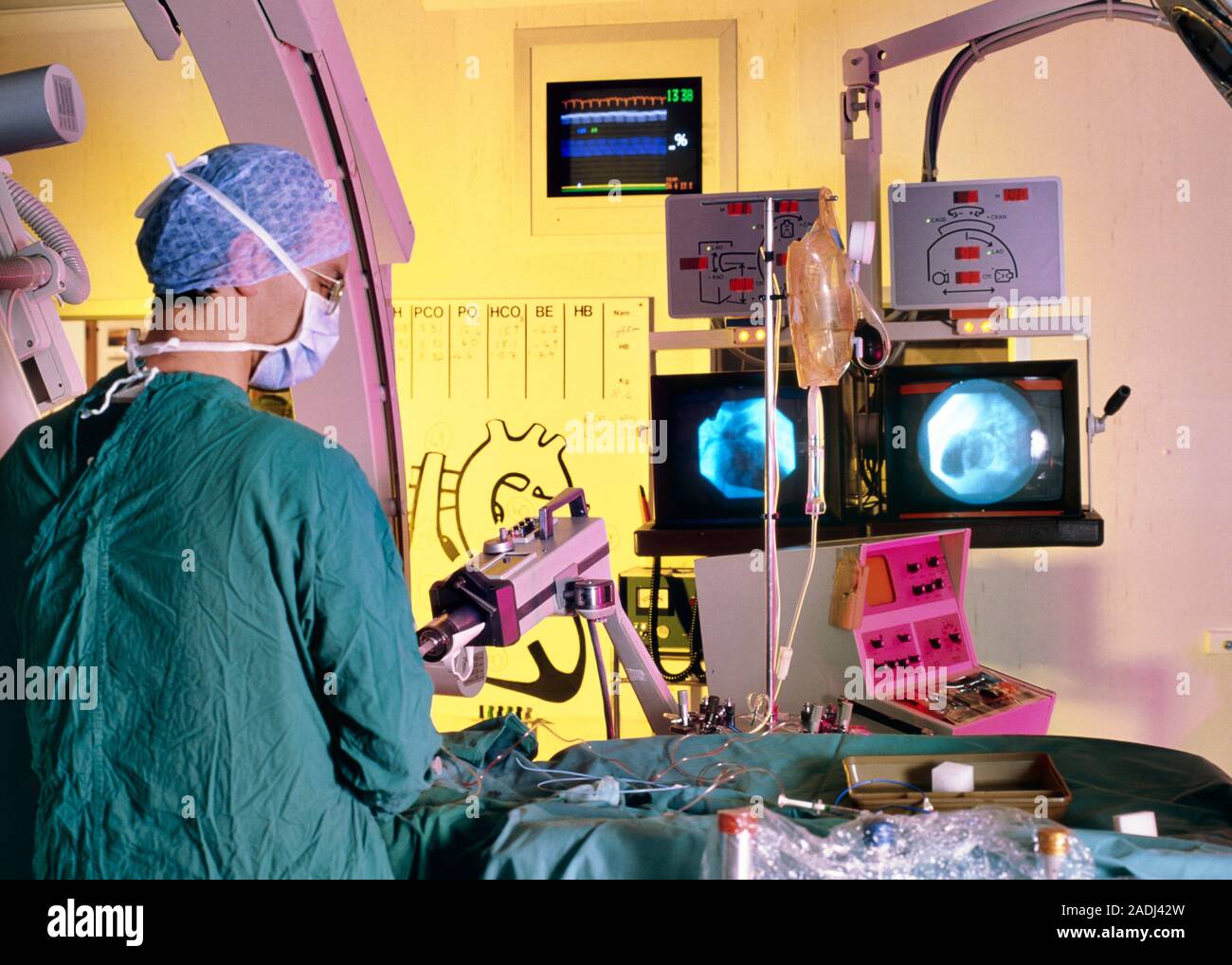 Cardiac catheterization of an infant to assess Fallot's tetralogy, a ...