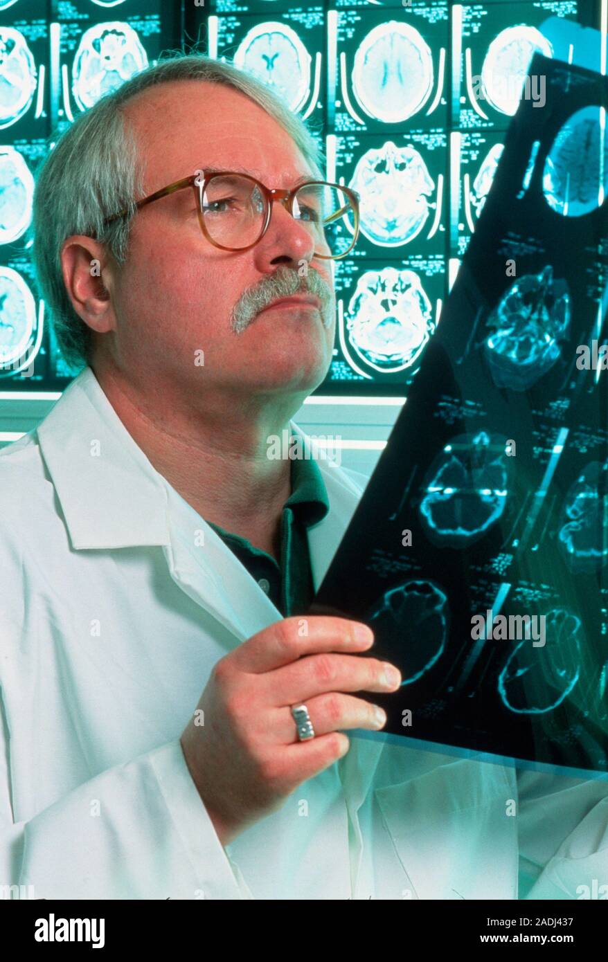 Doctor studying film sheet of computed tomography (CT) scans of various ...