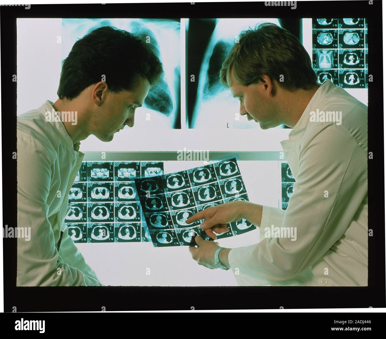 X-ray and CT scan diagnosis. Hospital radiologists at a light box ...