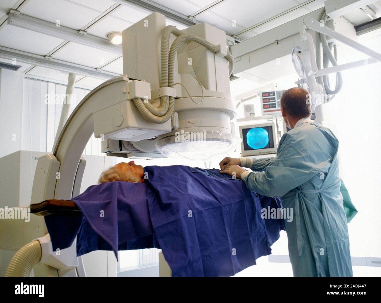 Coronary angiography. Patient undergoing an X-ray angiography ...