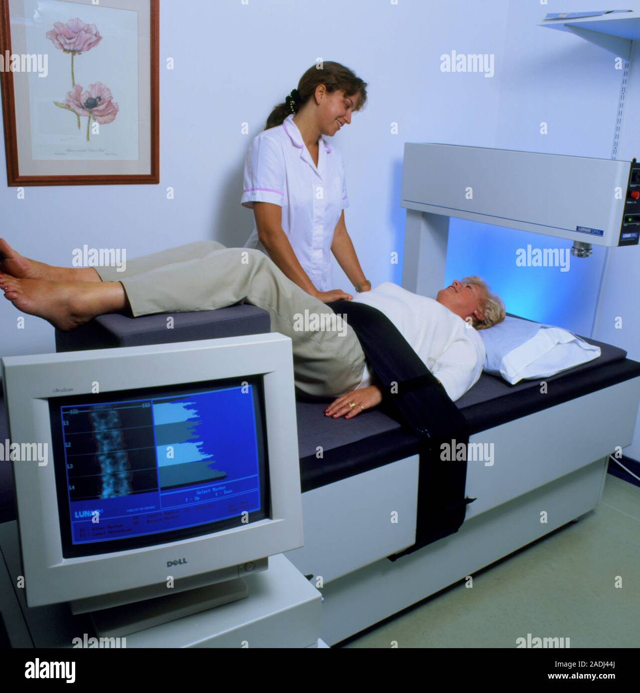 Osteoporosis bone scanning. Nurse checks on an elderly female ...