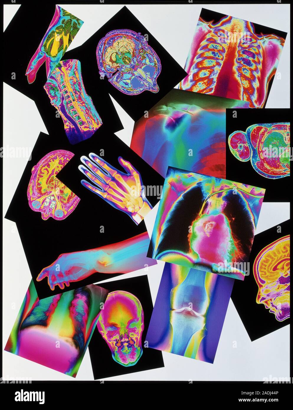 X-ray diagnosis. Assortment of coloured X-rays, body and brain scans on a light box. Parts of ...