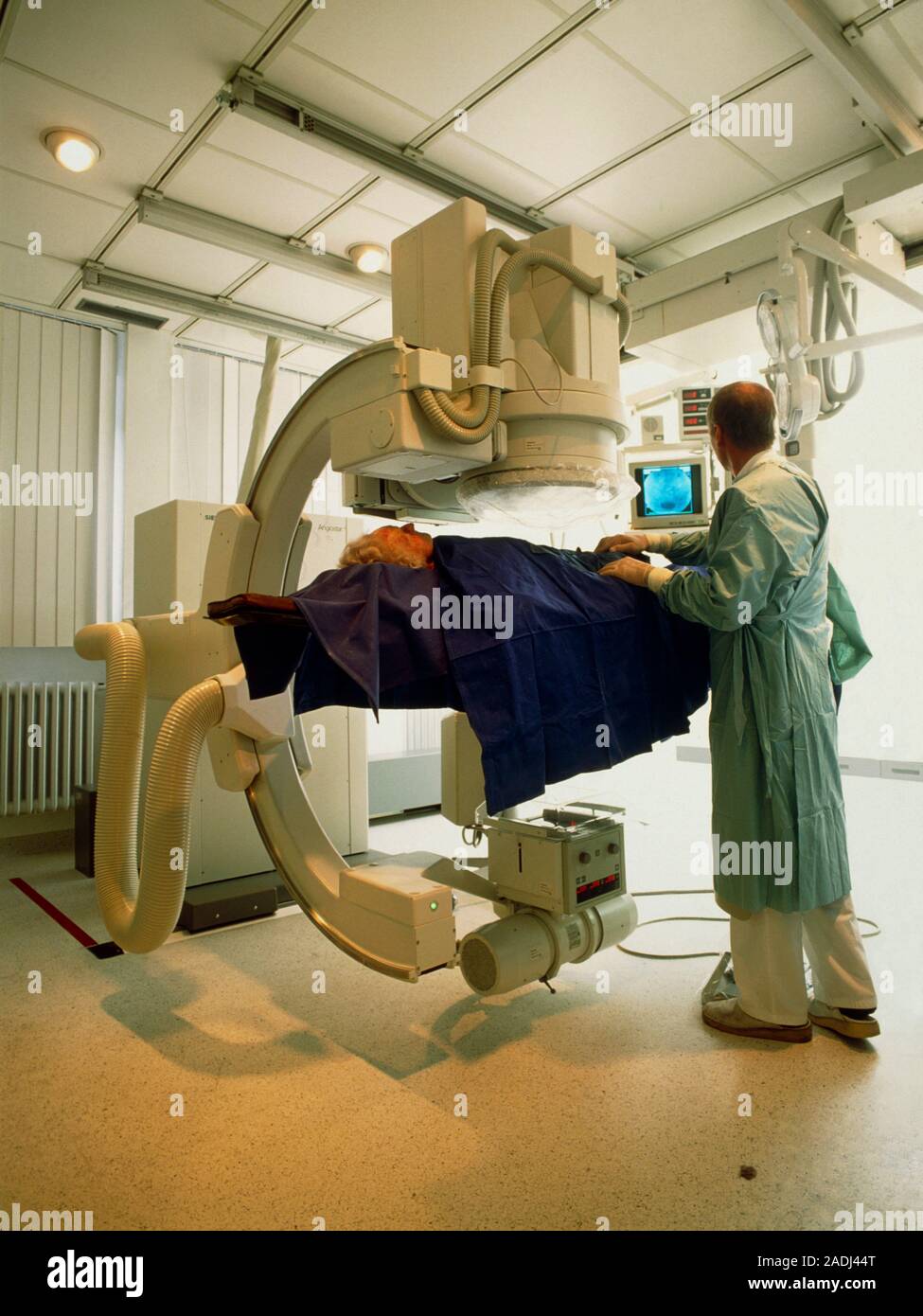 Coronary angiography. Patient undergoing an X-ray angiography ...