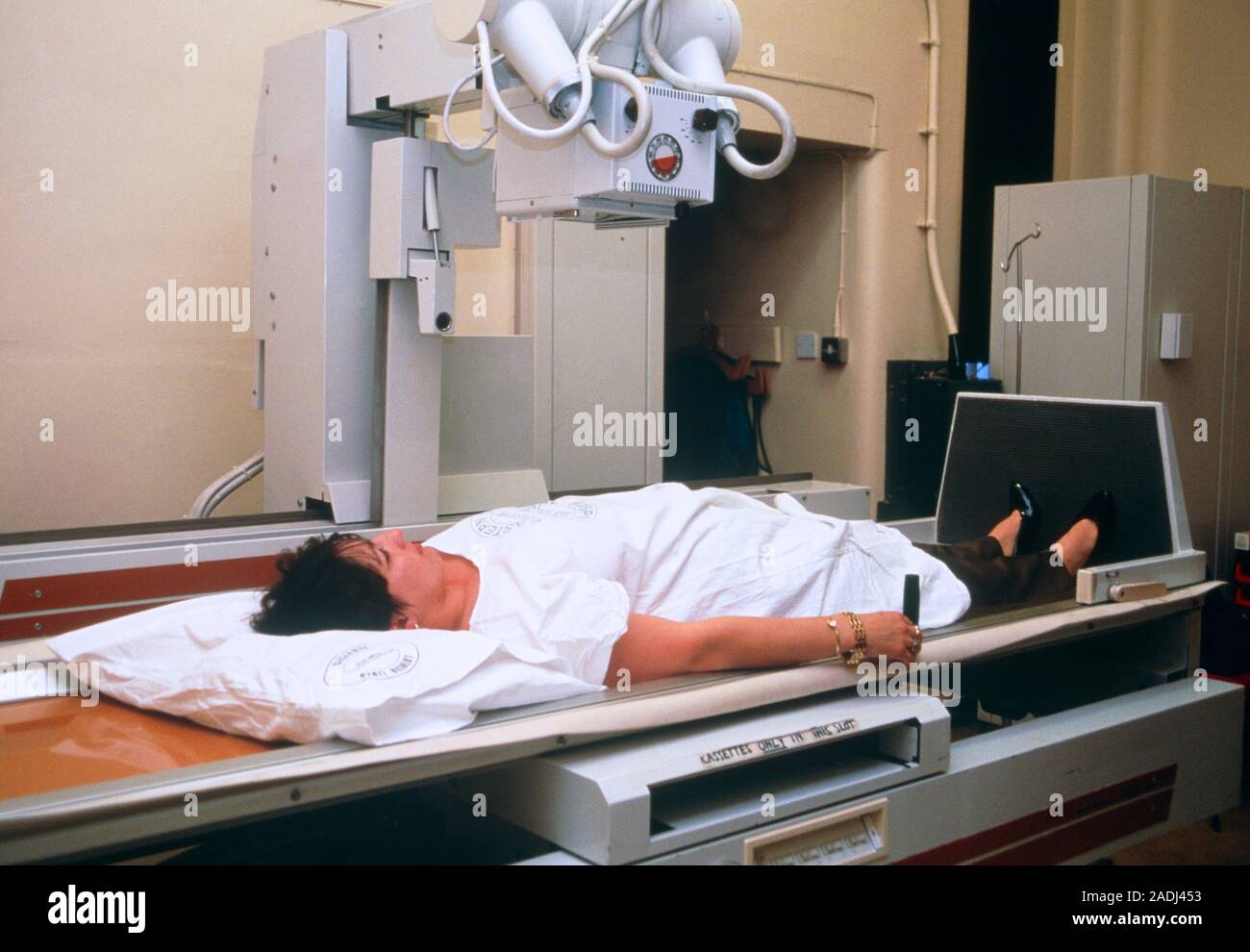 Barium meal X-ray. Female patient undergoing an abdominal barium X-ray ...