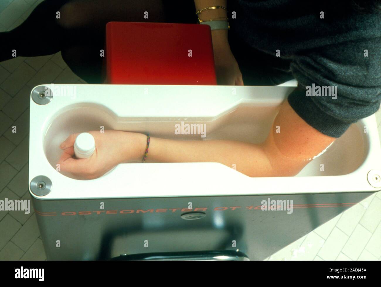 Bone densitometer. View of a woman's forearm undergoing a densitometry ...