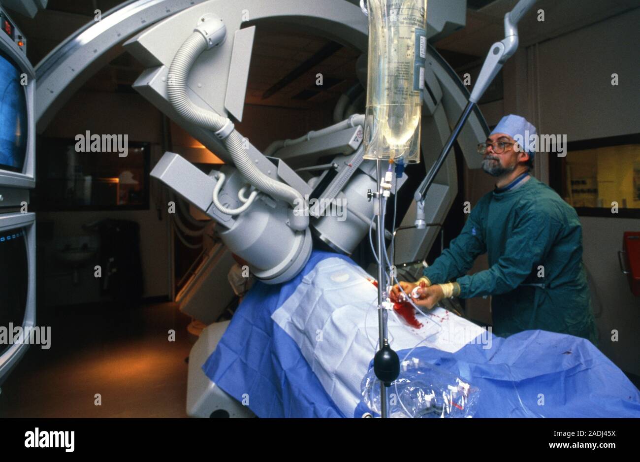 Angiography. Surgeon studying an angiogram (far right) of a patient's ...