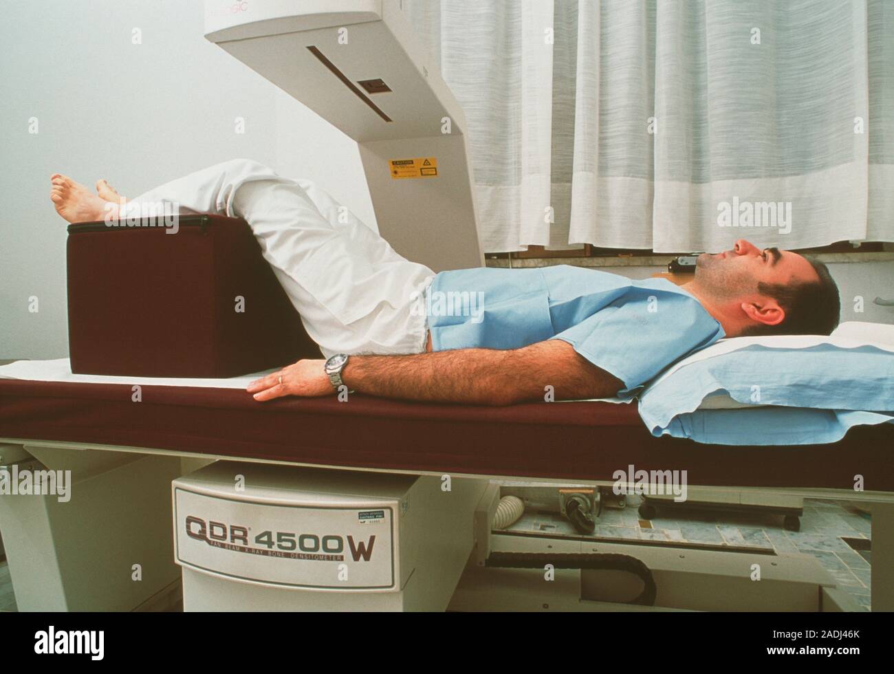 Bone scanning. Rheumatoid arthritis patient lying under a bone ...