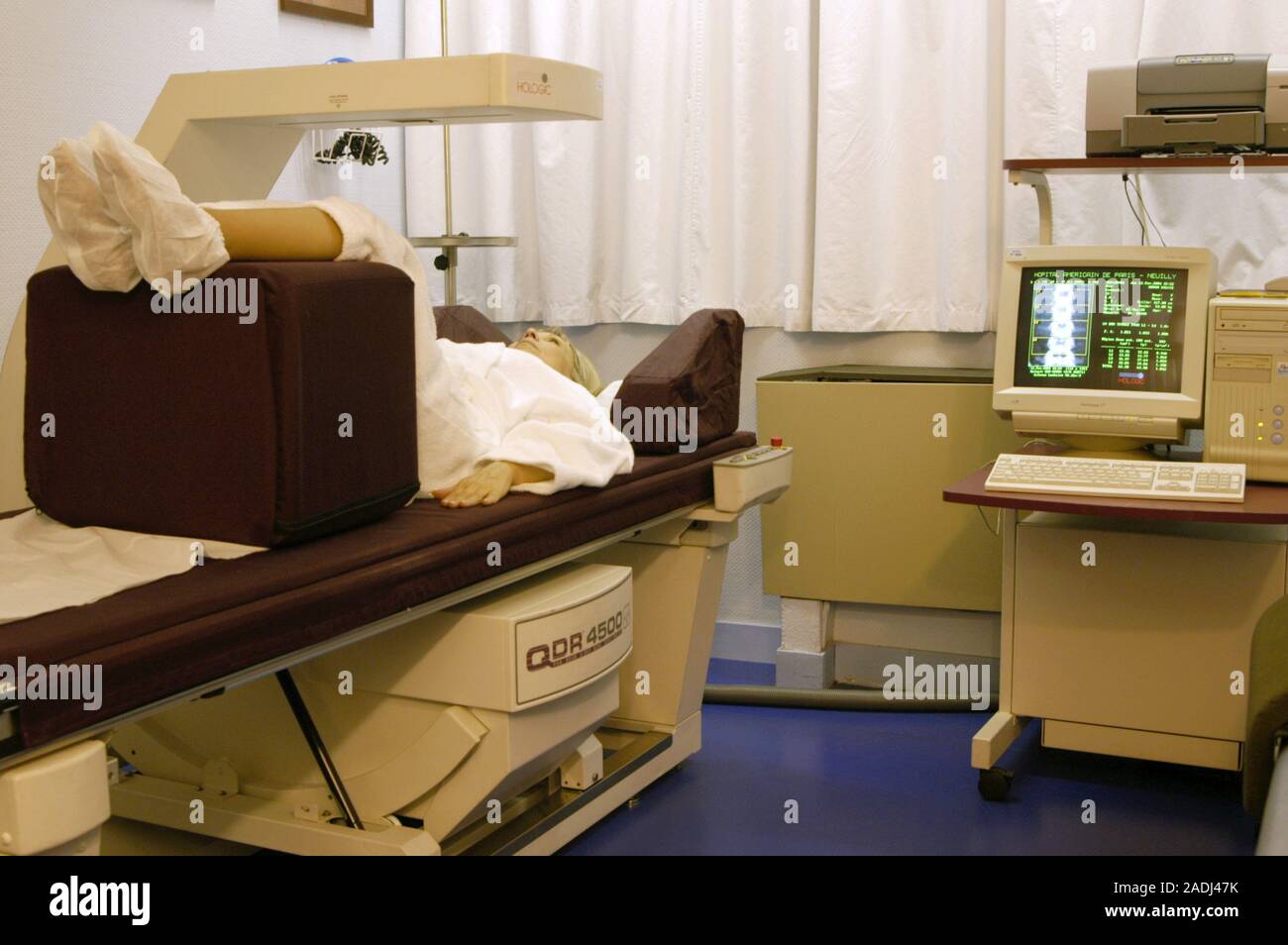 Bone scan. 63-year-old woman undergoing a bone densitometry scan of her ...