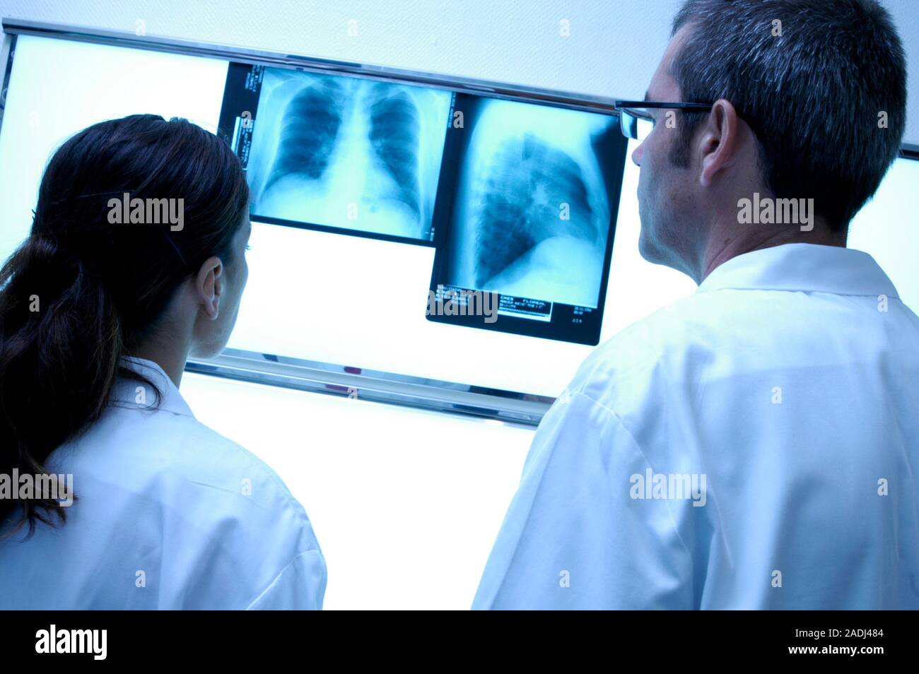 X-ray diagnosis. Doctors examining a patient's chest X-rays. The X-rays ...