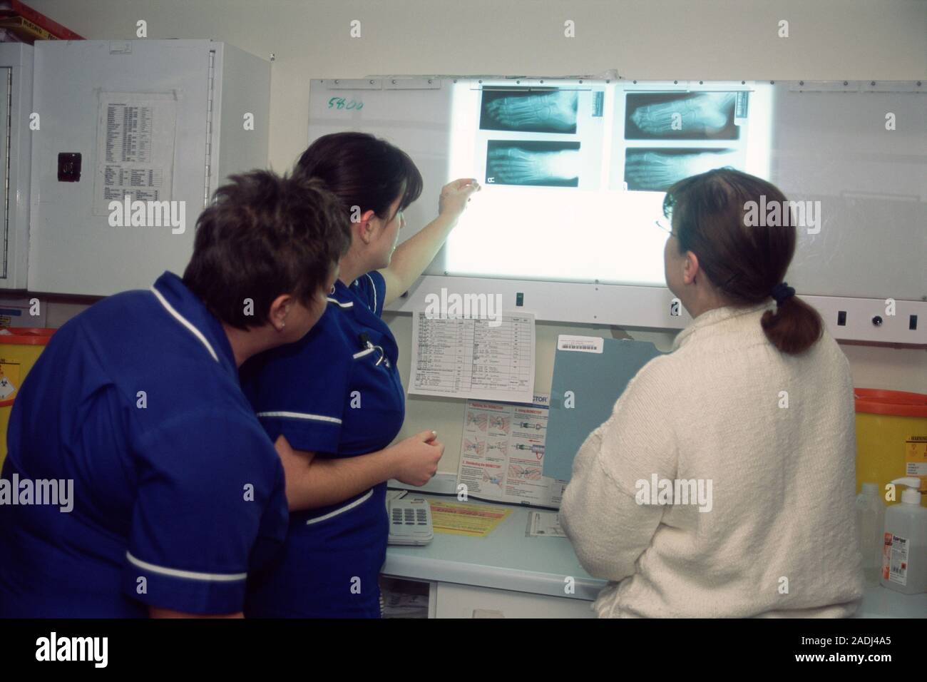 Examining X-rays. Hospital nurses (left) examining X-rays of a foot ...