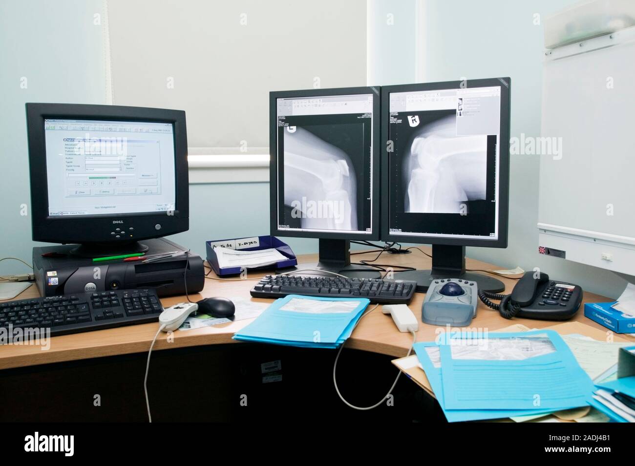 Viewing X-rays. Digital X-rays of a patient's knee on computer screens ...