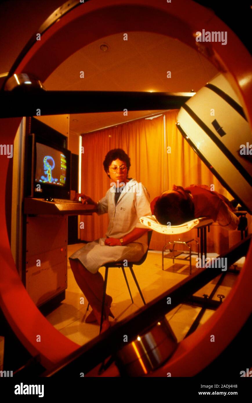 Gamma camera scanning of the head of a person suffering from secondary ...