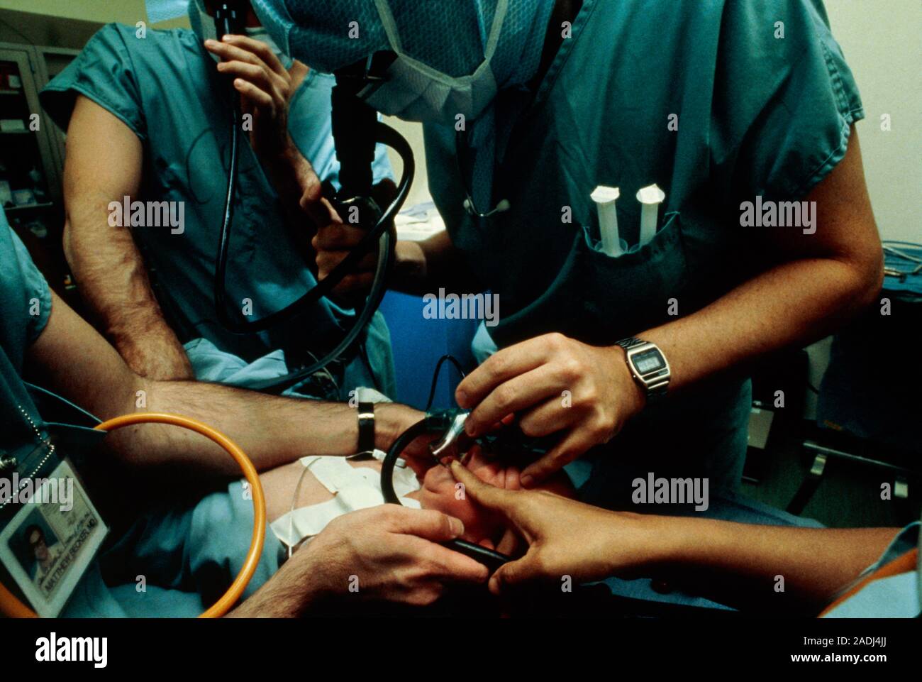 Doctors in a hospital in Washington, D.C., using a bronchoscope (a type ...