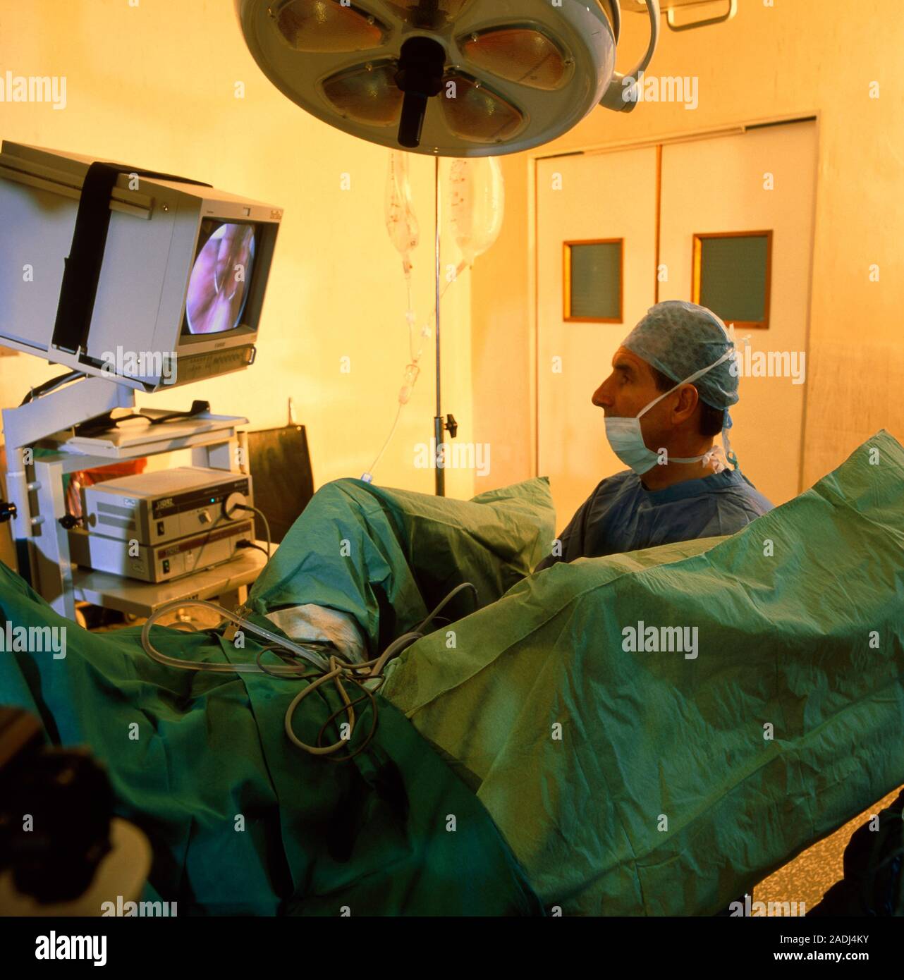 Endoscopy. Surgeon using an endoscope to take a tissue sample (biopsy ...