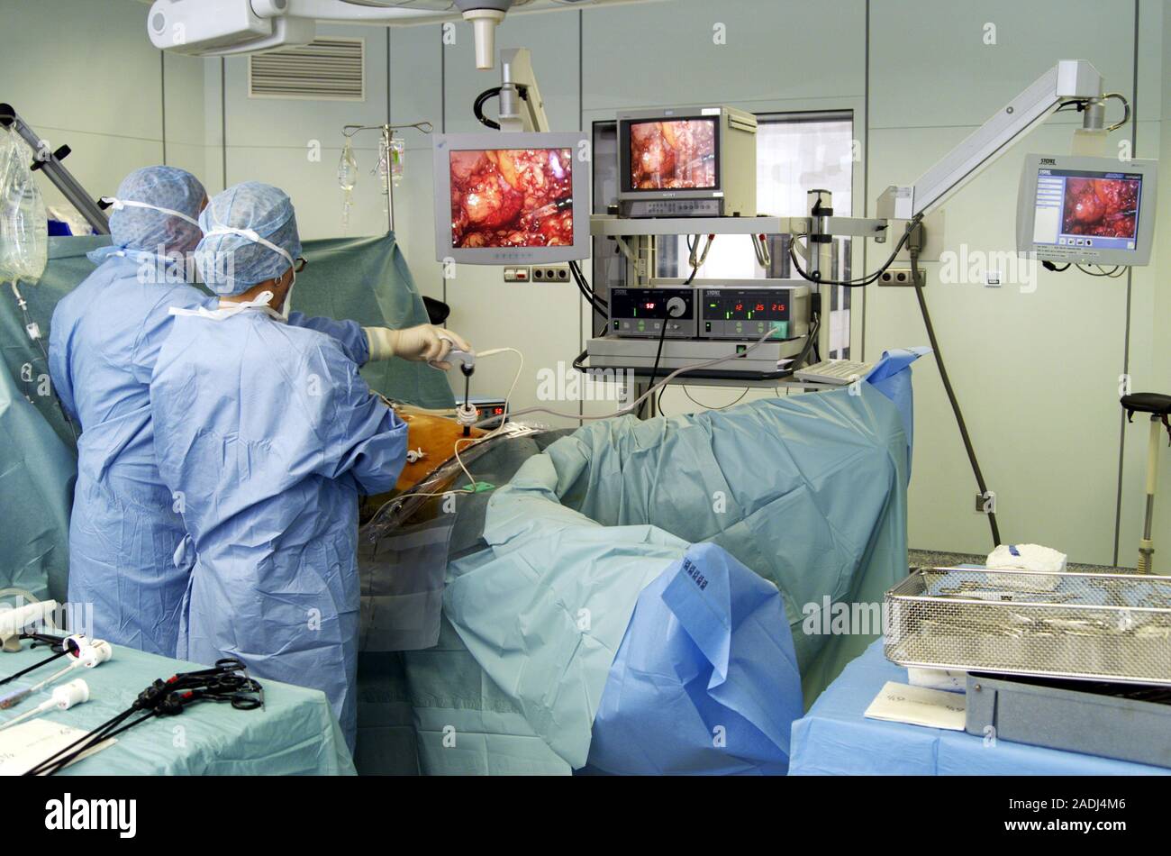 Colocolostomy. Surgeon and assistant performing a colocolostomy on a ...