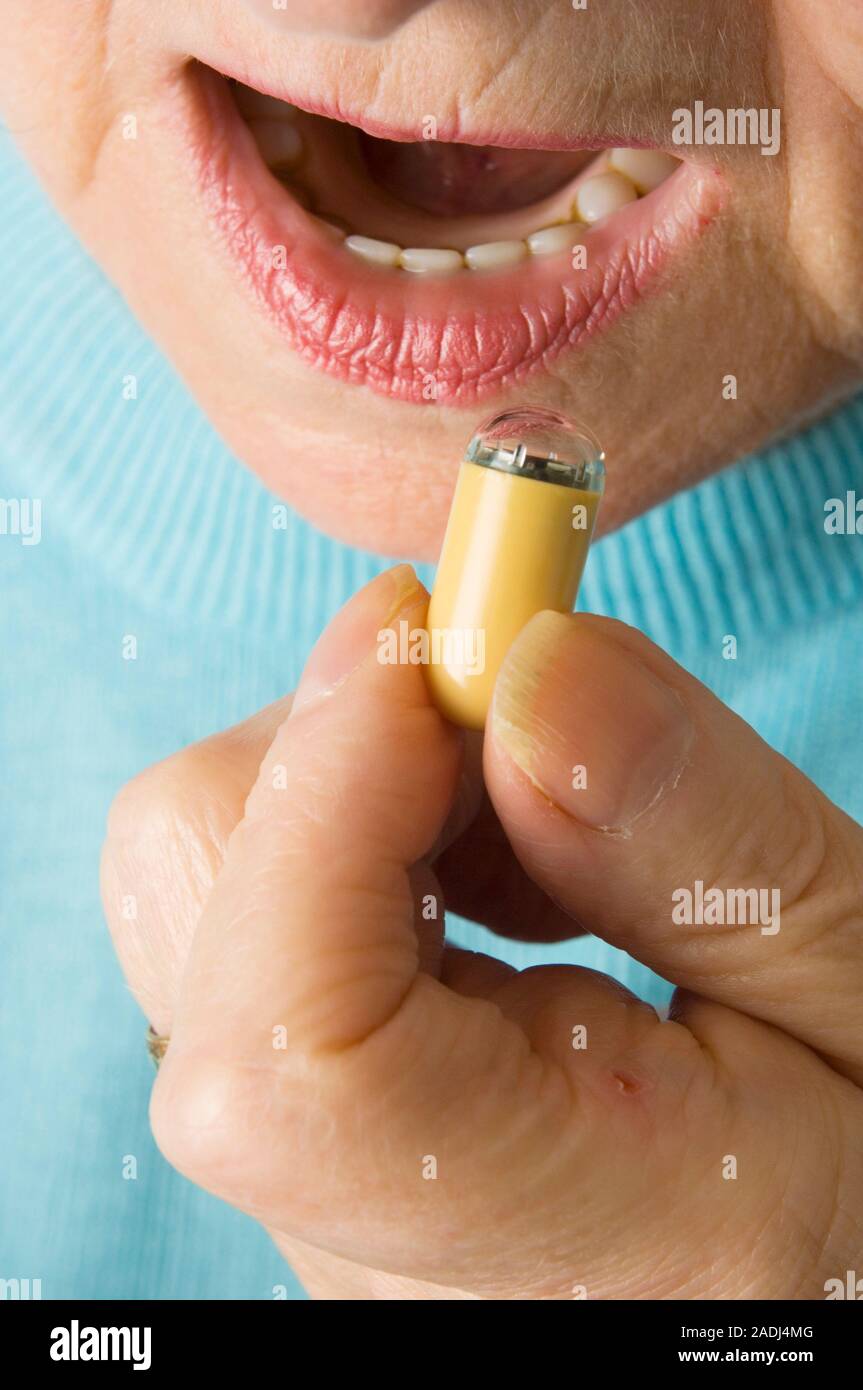 Pill camera. Woman about to swallow a pill camera. The lens is housed ...