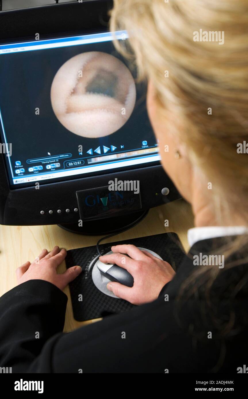 Pill camera. Doctor viewing images from a pill camera on a computer ...