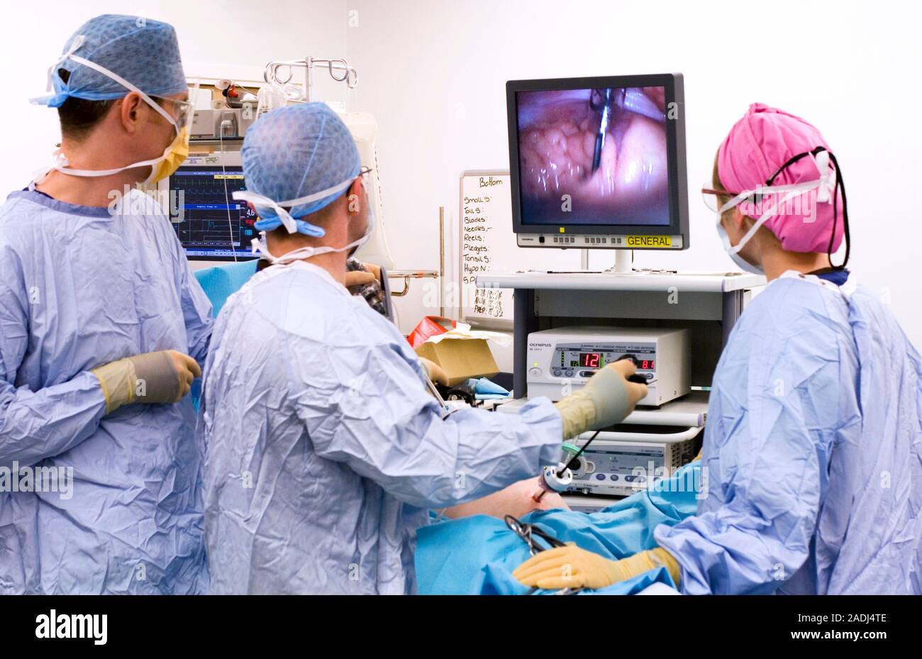 MODEL RELEASED. Laparoscopic surgery. Surgeon performing laparoscopic ...