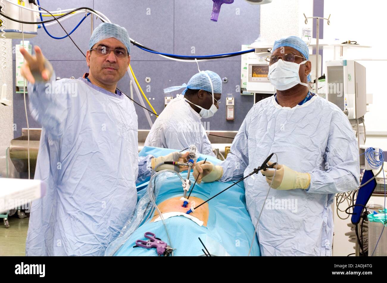 MODEL RELEASED. Hernia operation. Surgeons performing laparoscopic ...