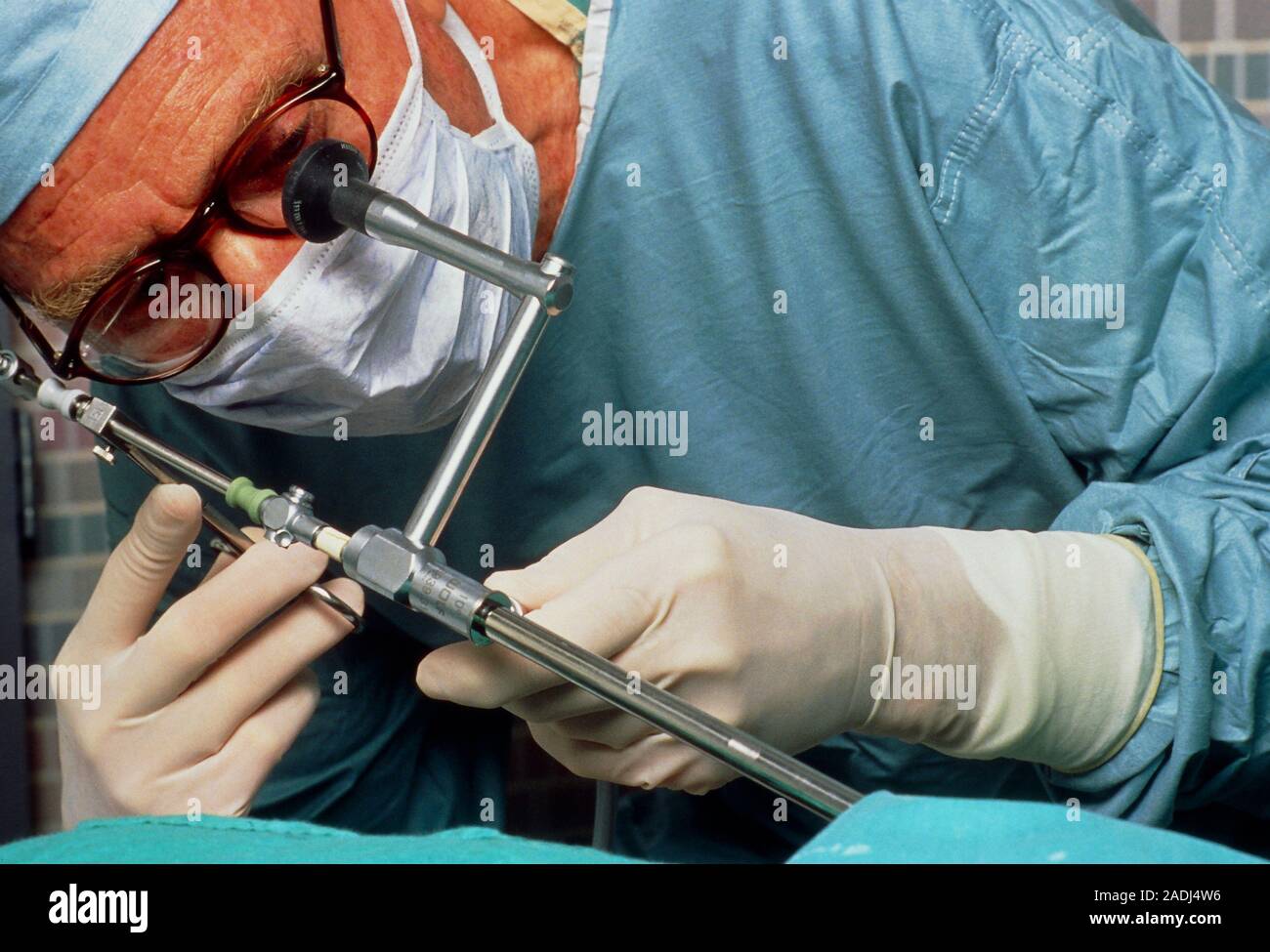 Laparoscope examination of a patient's abdomen. A laparoscope (a type ...