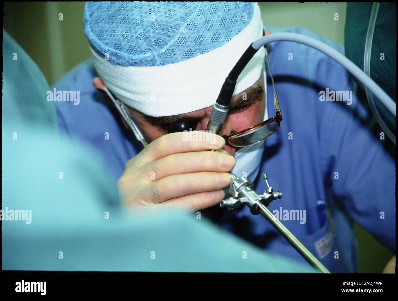Laparoscopy. View of a surgeon using a laparoscope during surgery. A ...