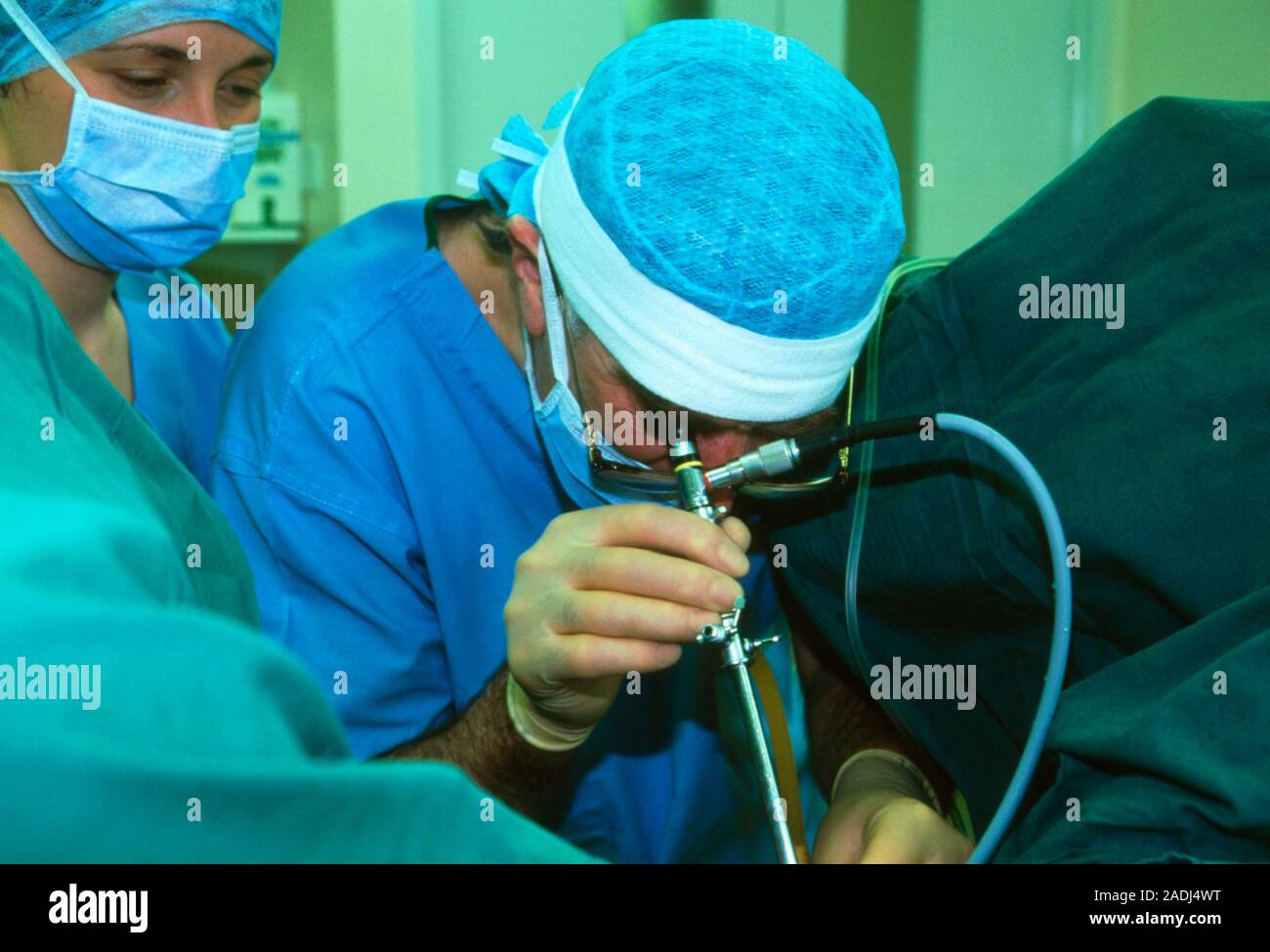 Laparoscopy. View of a surgeon using a laparoscope during surgery. A ...