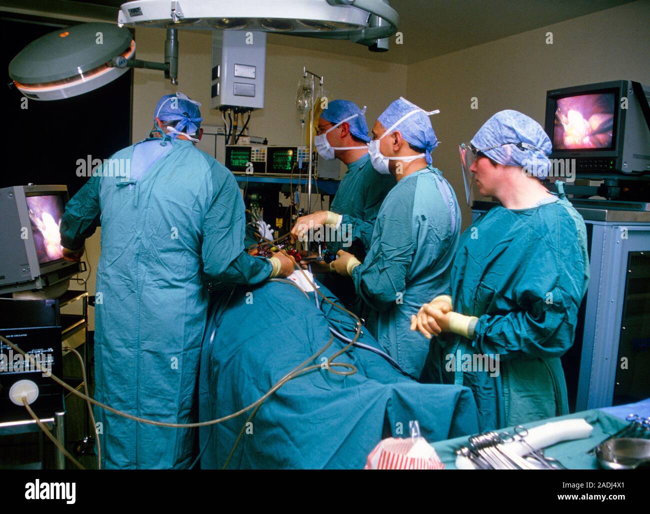 Laparoscopy. View of a surgeon using a number of laparoscopes during ...