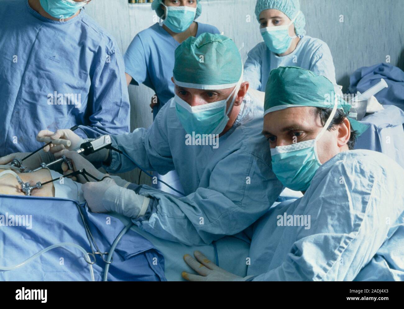 Laparoscopy. Surgeons operate laparoscopes during abdominal key-hole ...