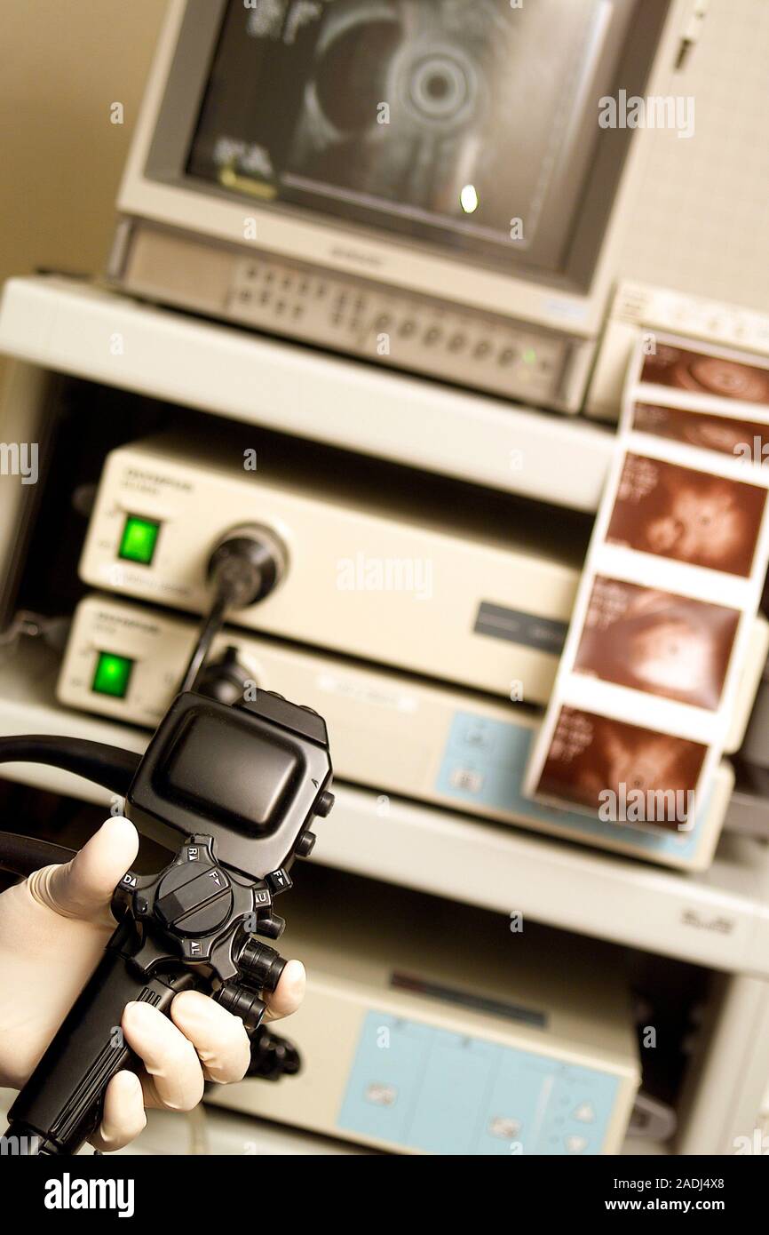 Endoscopy. Hand holding a control unit (lower left) for an endoscope ...