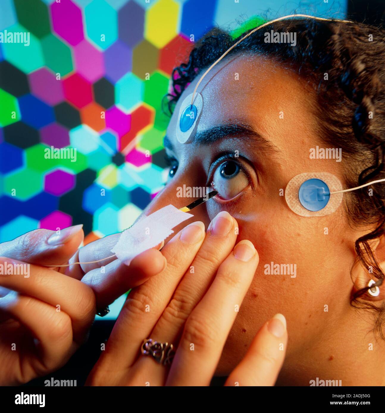 Electroretinogram. Hands attaching a gold-foil electrode to a woman's ...