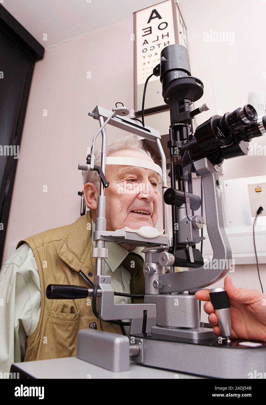 MODEL RELEASED. Eye examination. Patient with mild iritis (inflammation ...