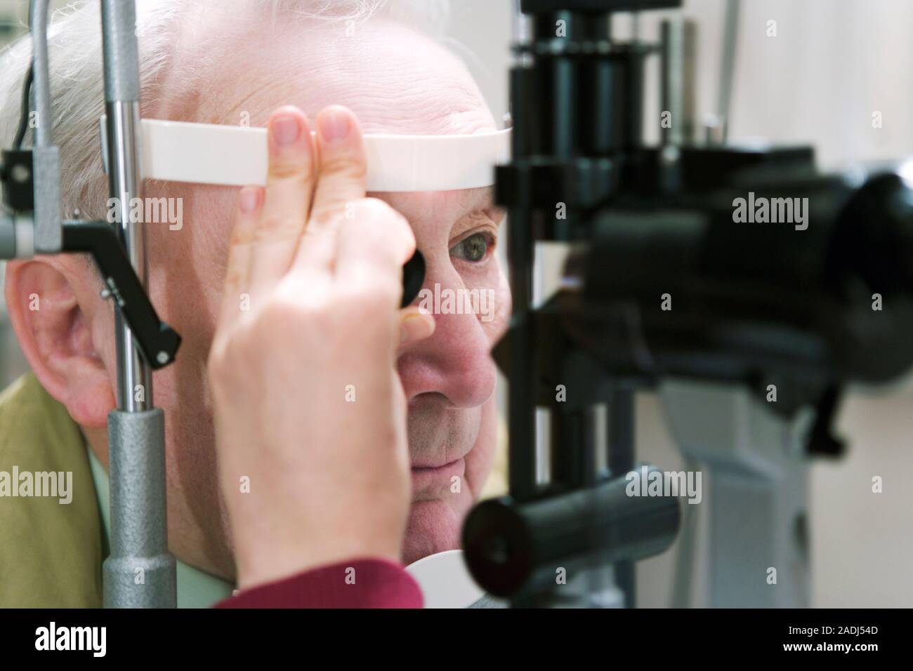 MODEL RELEASED. Eye examination. Patient with mild iritis (inflammation ...