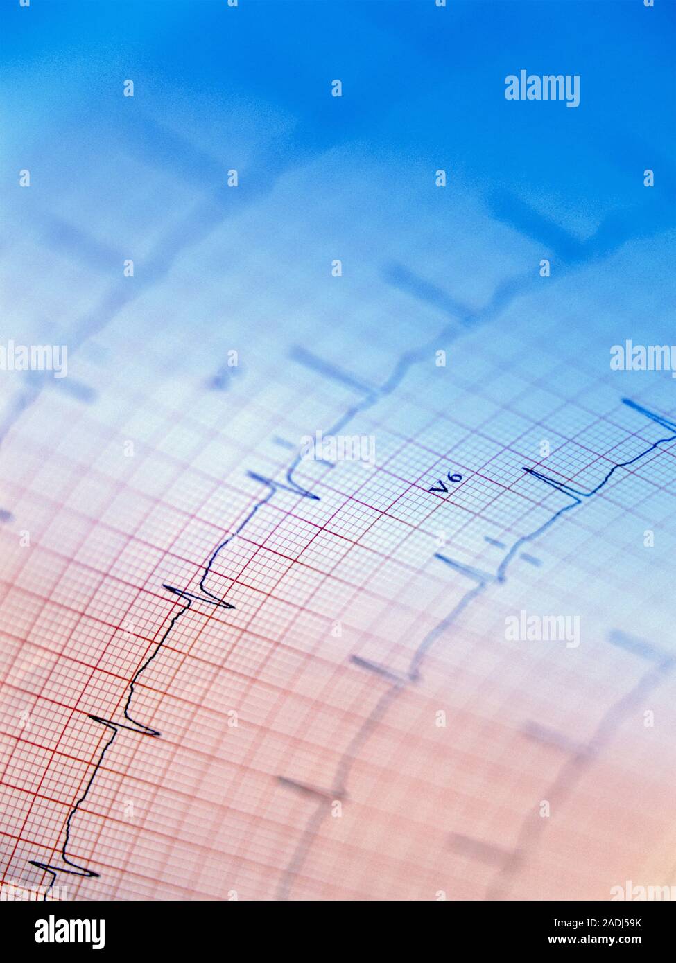 Electrocardiogram (ECG) trace. Print-out from an ECG machine showing ...