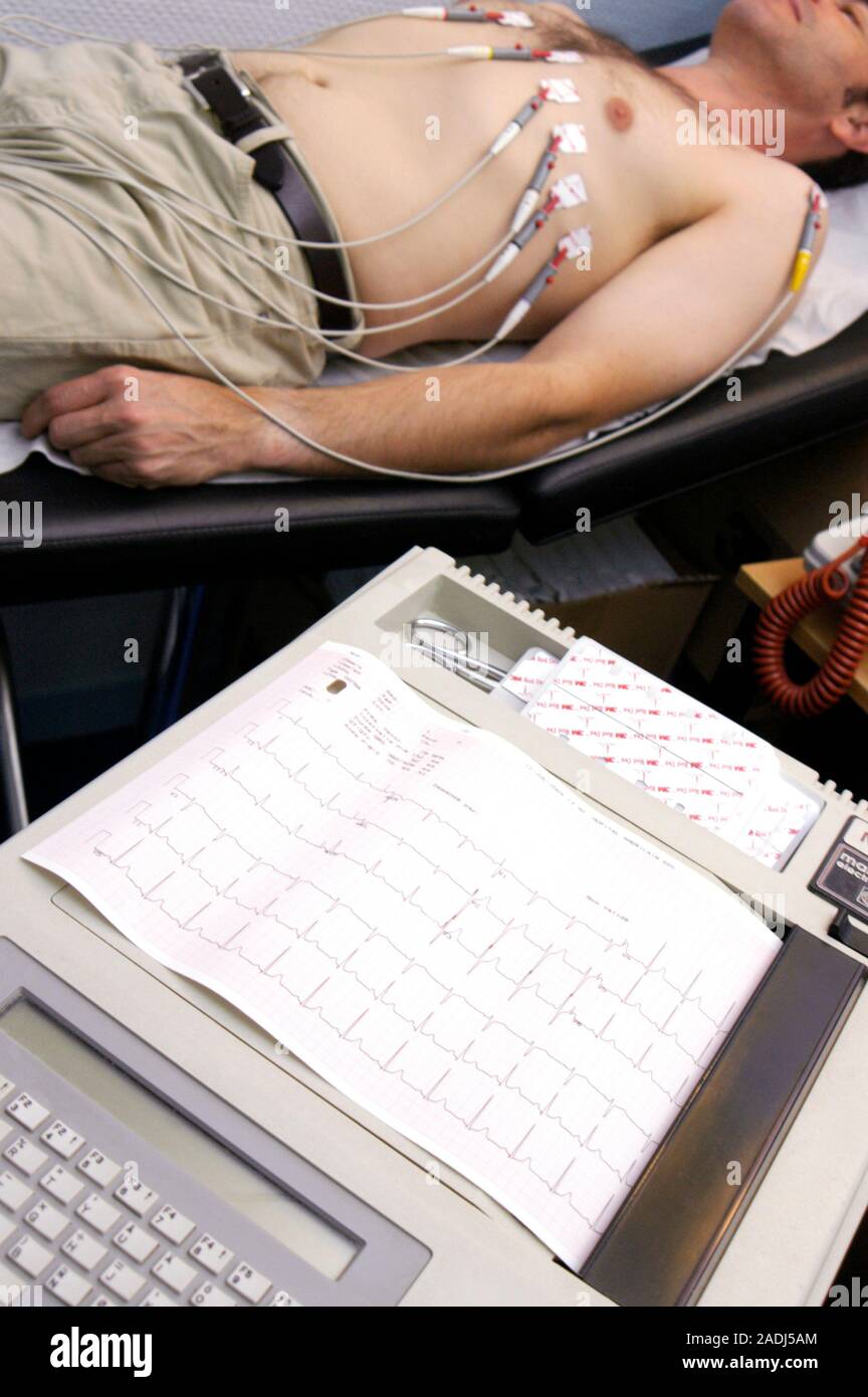 MODEL RELEASED. Electrocardiography. 45-year-old man undergoing an ...