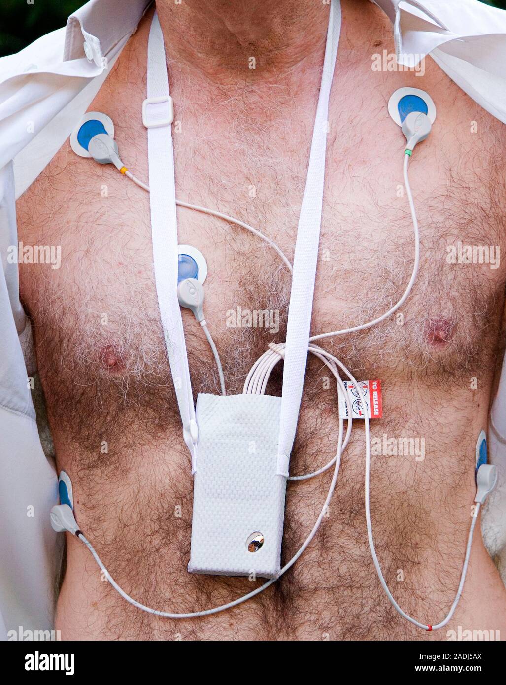 Portable heart monitor. Man wearing a portable electrocardiograph ...