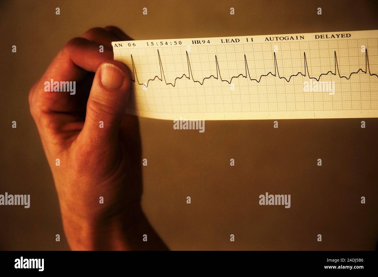 Electrocardiogram. Hands holding an electrocardiogram (ECG) of a normal ...
